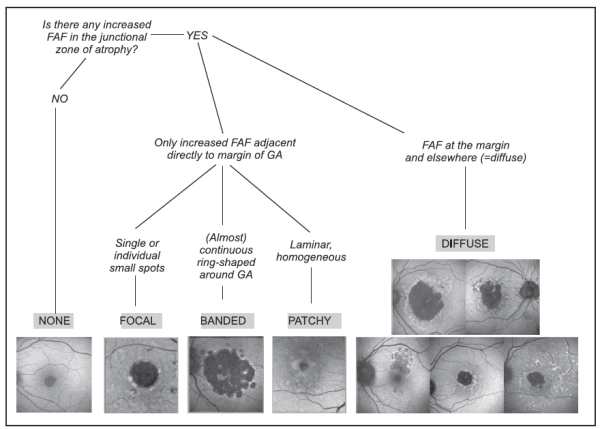 Fundus autofluorescence patterns and optical coherence tomography in ...